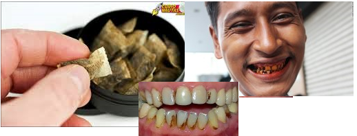 Fumo de mascar e seus malefícios a saude! :: draanaritarosaodontologia